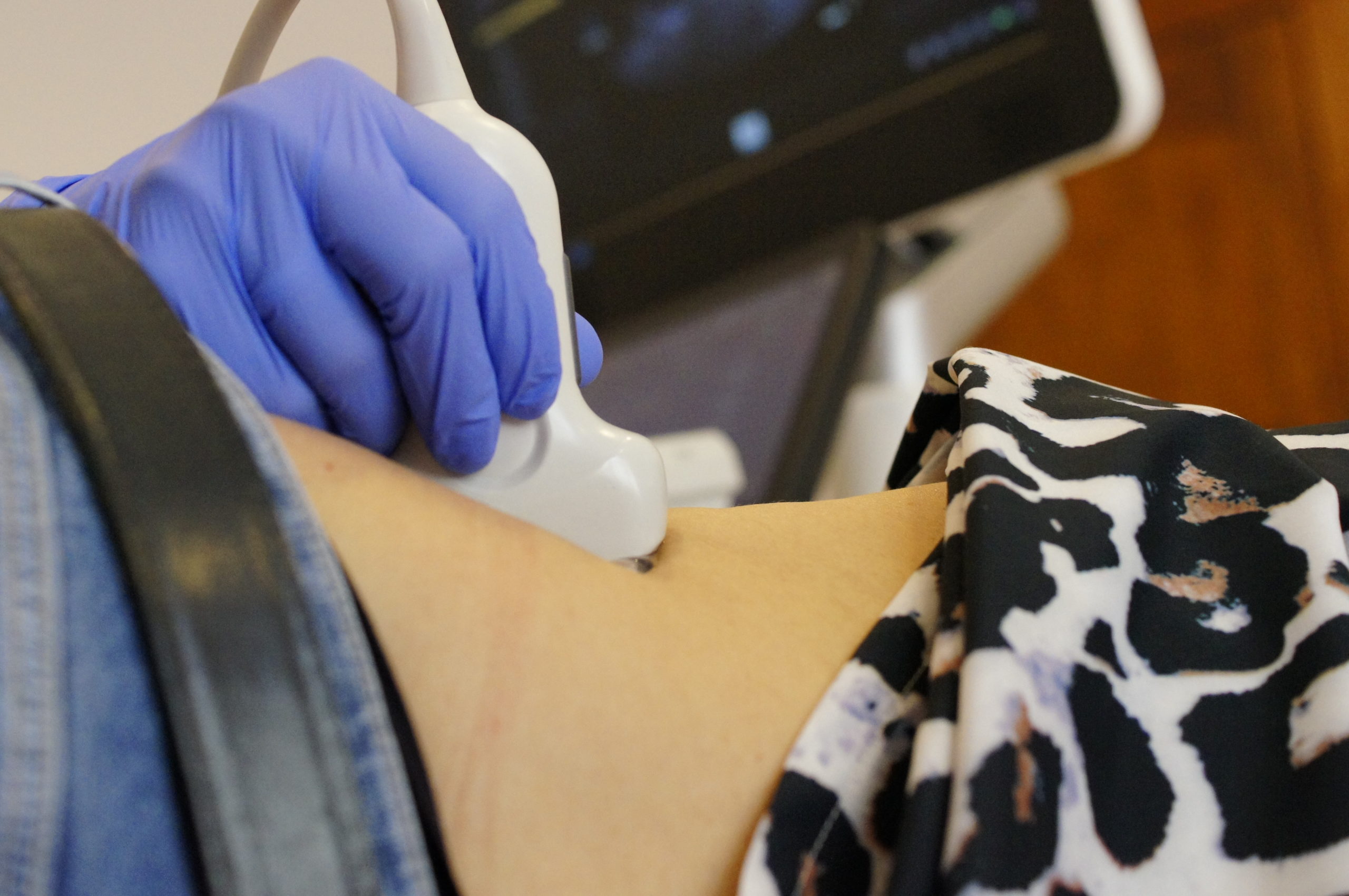 USG jamy brzusznej Bydgoszcz | USG brzucha | USG Joanna Drewa